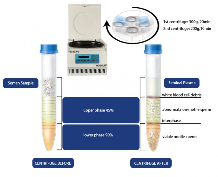China Sperm Centrifuge for IVF & IUI Laboratory - KETHINK - Centrifuges ...